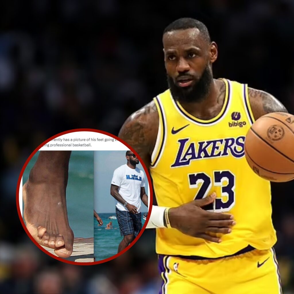 LeBron James’ Feet Grab Attention with Resurfaced Toe Picture ...