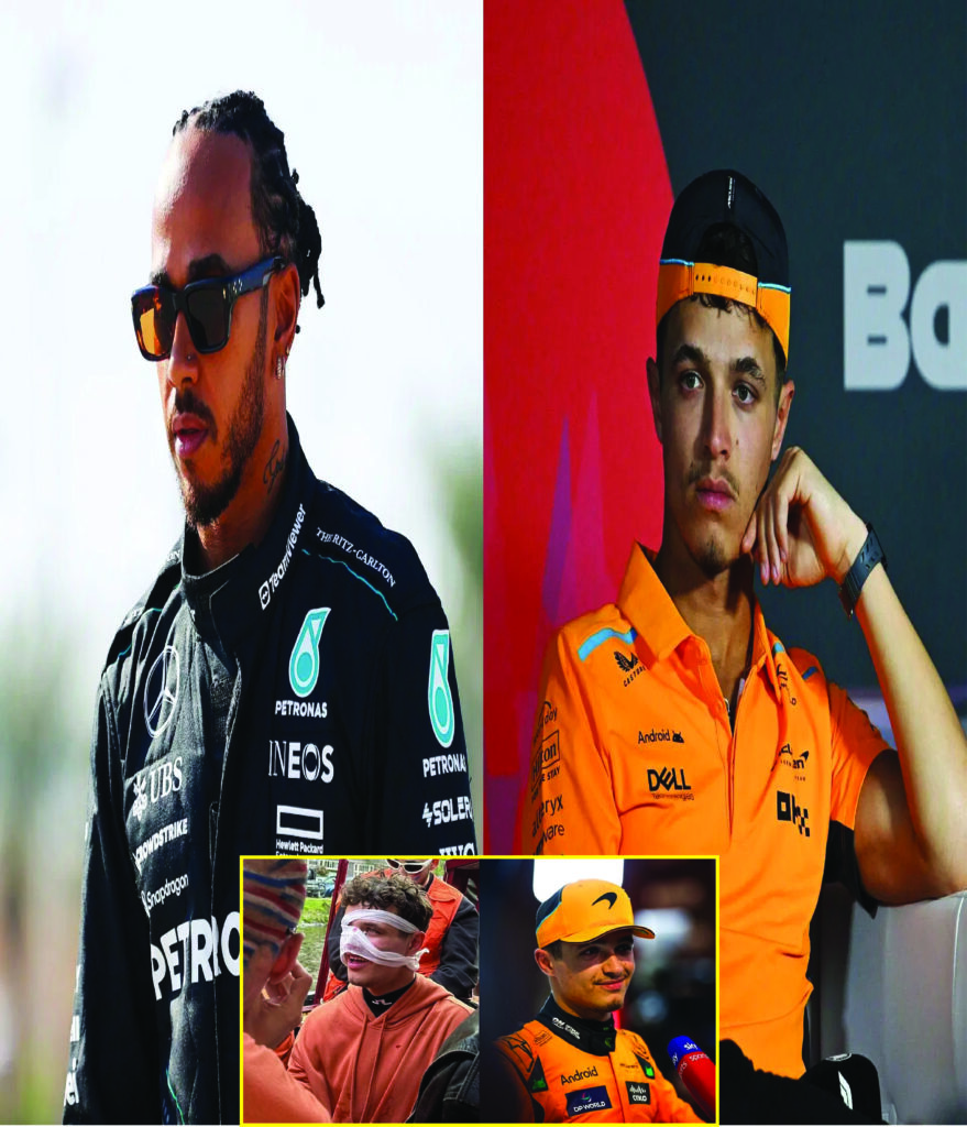 What Happened to Lando Norris’ Face? McLaren Star Goes Viral With ...